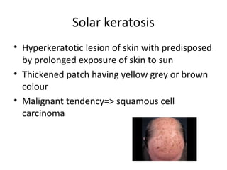 differential diagnosis -Malignant swellings | PPT