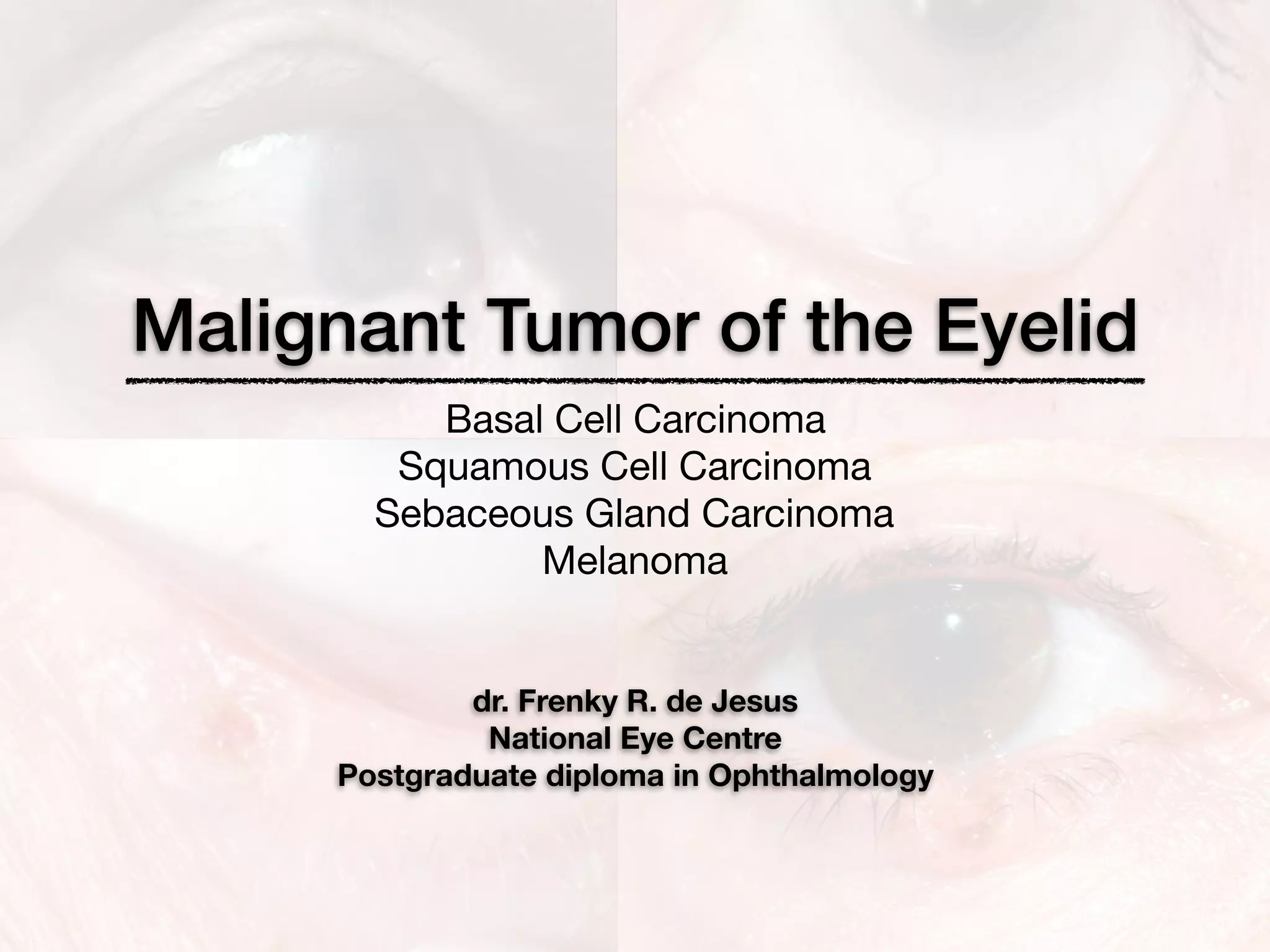 Malignant tumor of the eyelid | PDF