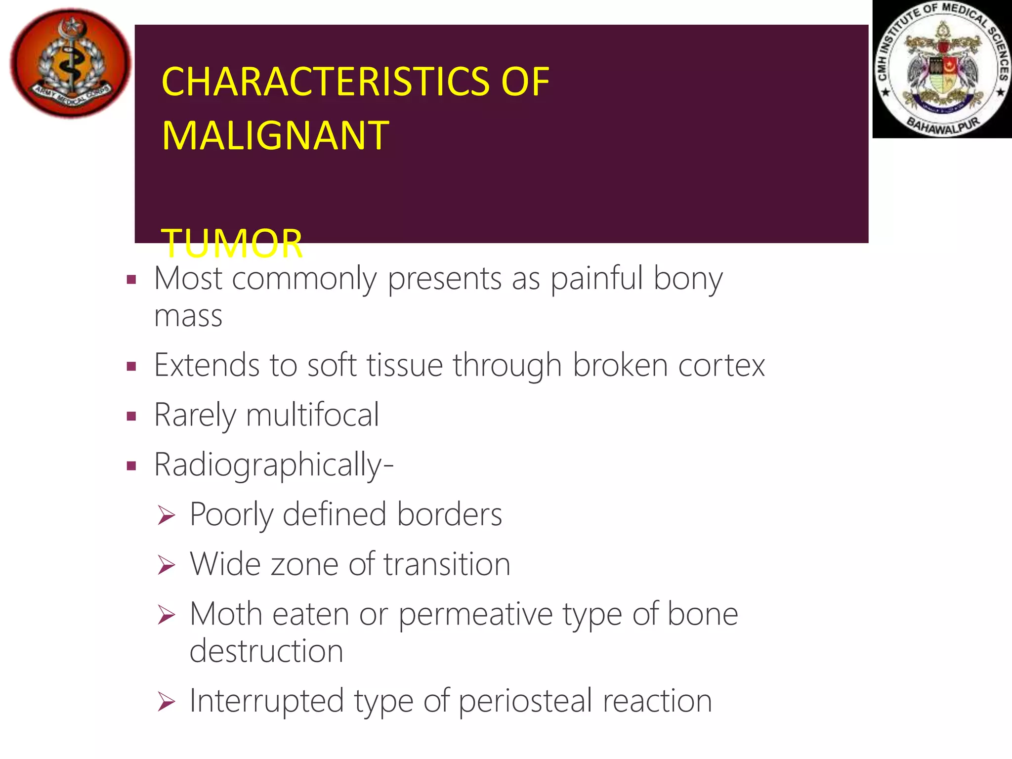 malignant tumors of bone.pptx