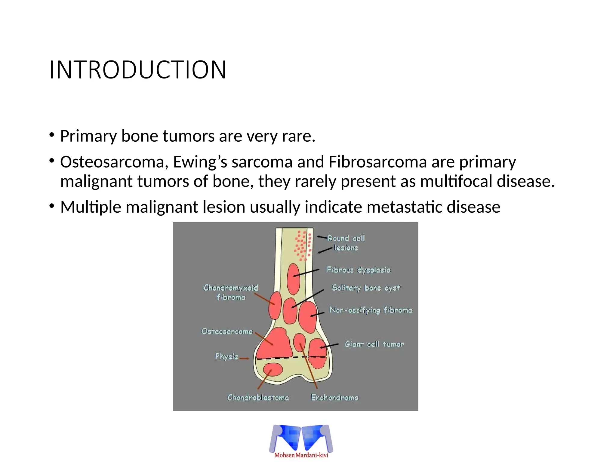 MALIGNANT TUMORS OF BONEffffffffffffffffffff.pptx