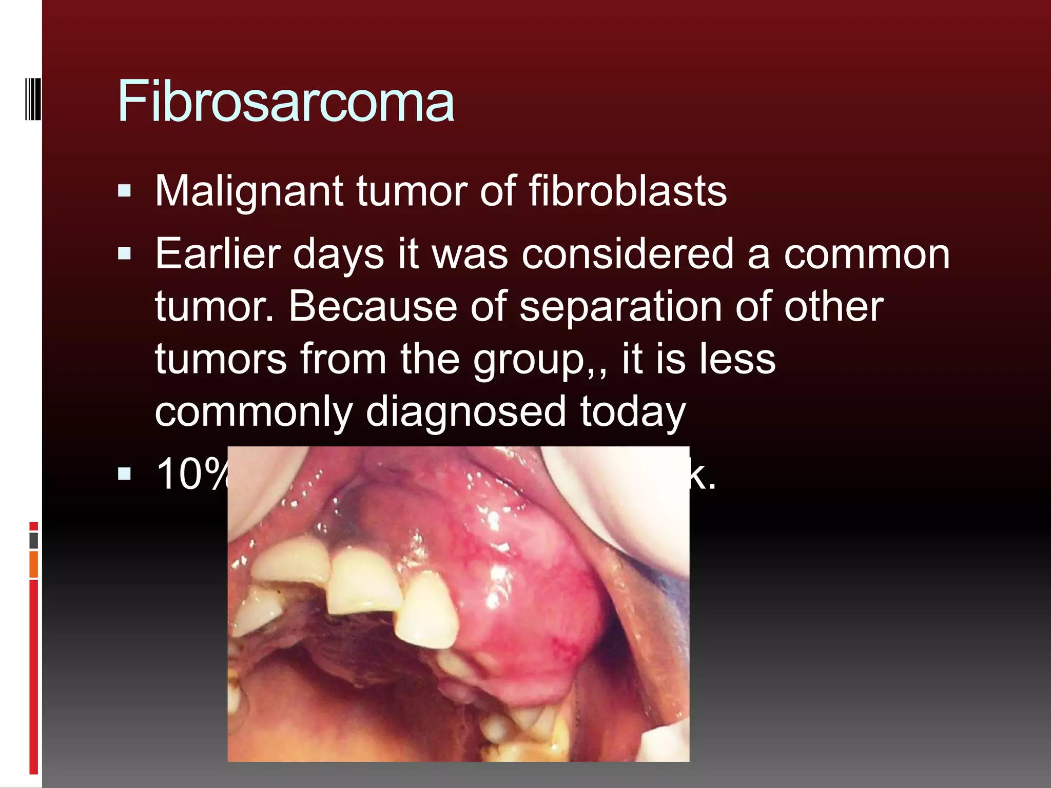 Malignant tumors of connective tissue origin | PPTX | Cancer | Diseases ...