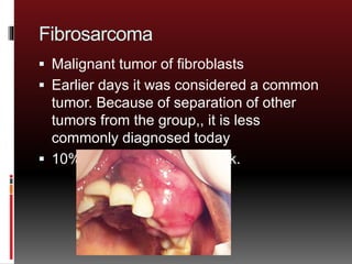 Malignant tumors of connective tissue origin | PPTX