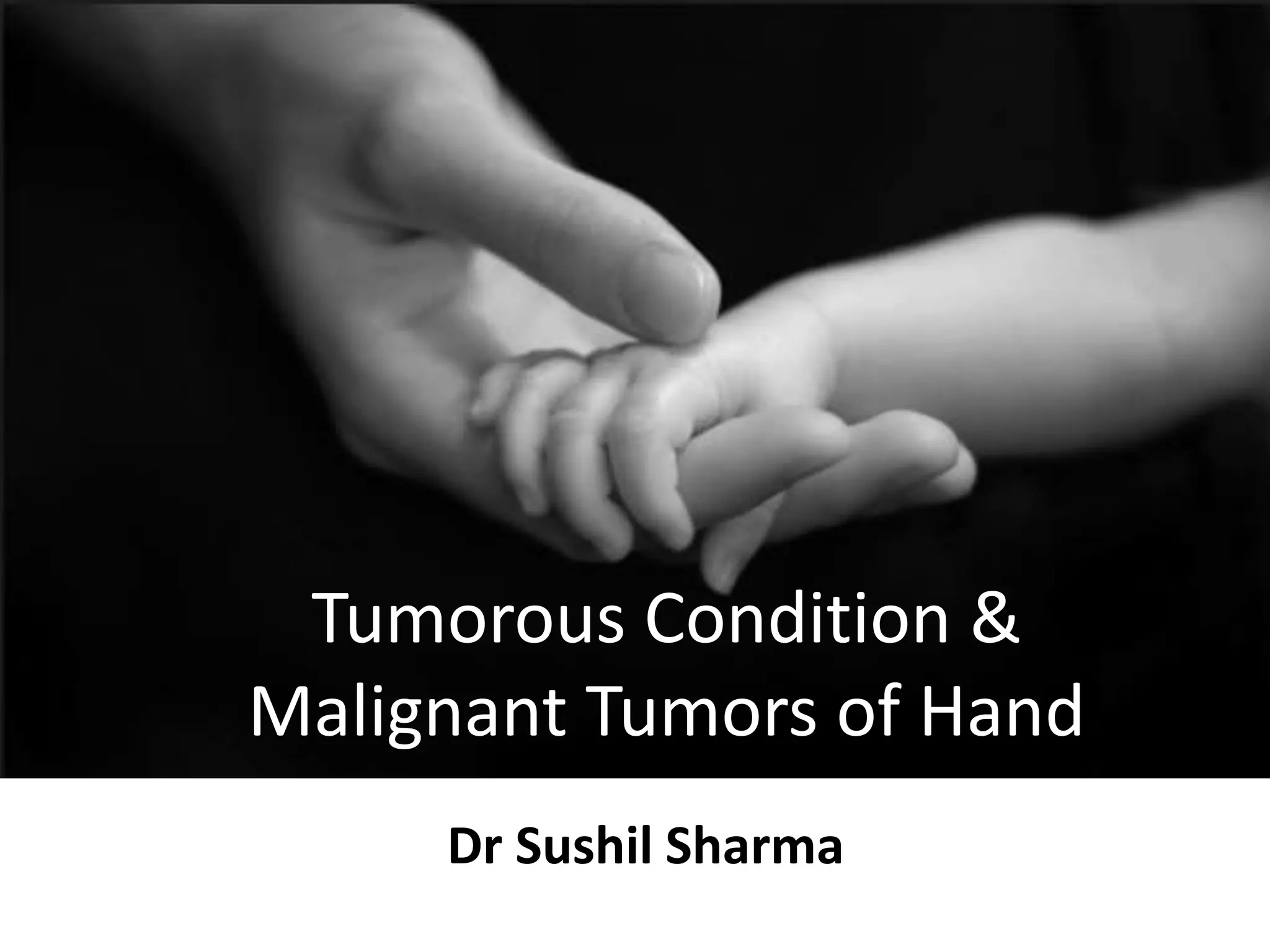 Malignant tumors of hand | PPTX | Death, Injury, or Military Conflict ...