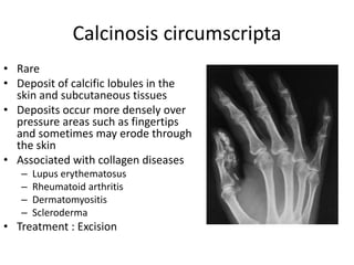 Malignant tumors of hand | PPTX