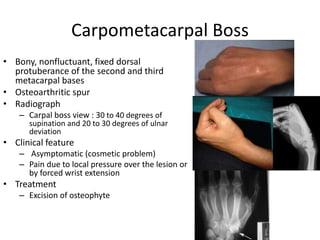 Malignant tumors of hand | PPTX
