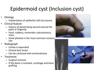 Malignant tumors of hand | PPTX