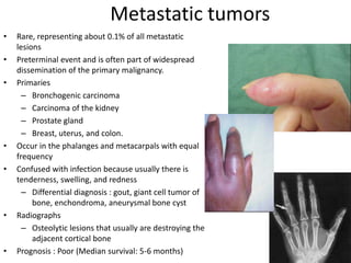 Malignant Tumors Of The Hand