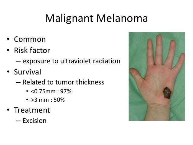 Malignant Tumors Of Hand