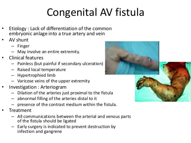 Malignant tumors of hand