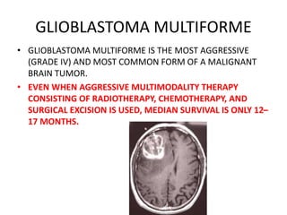 Malignant tumors of the brain | PPT