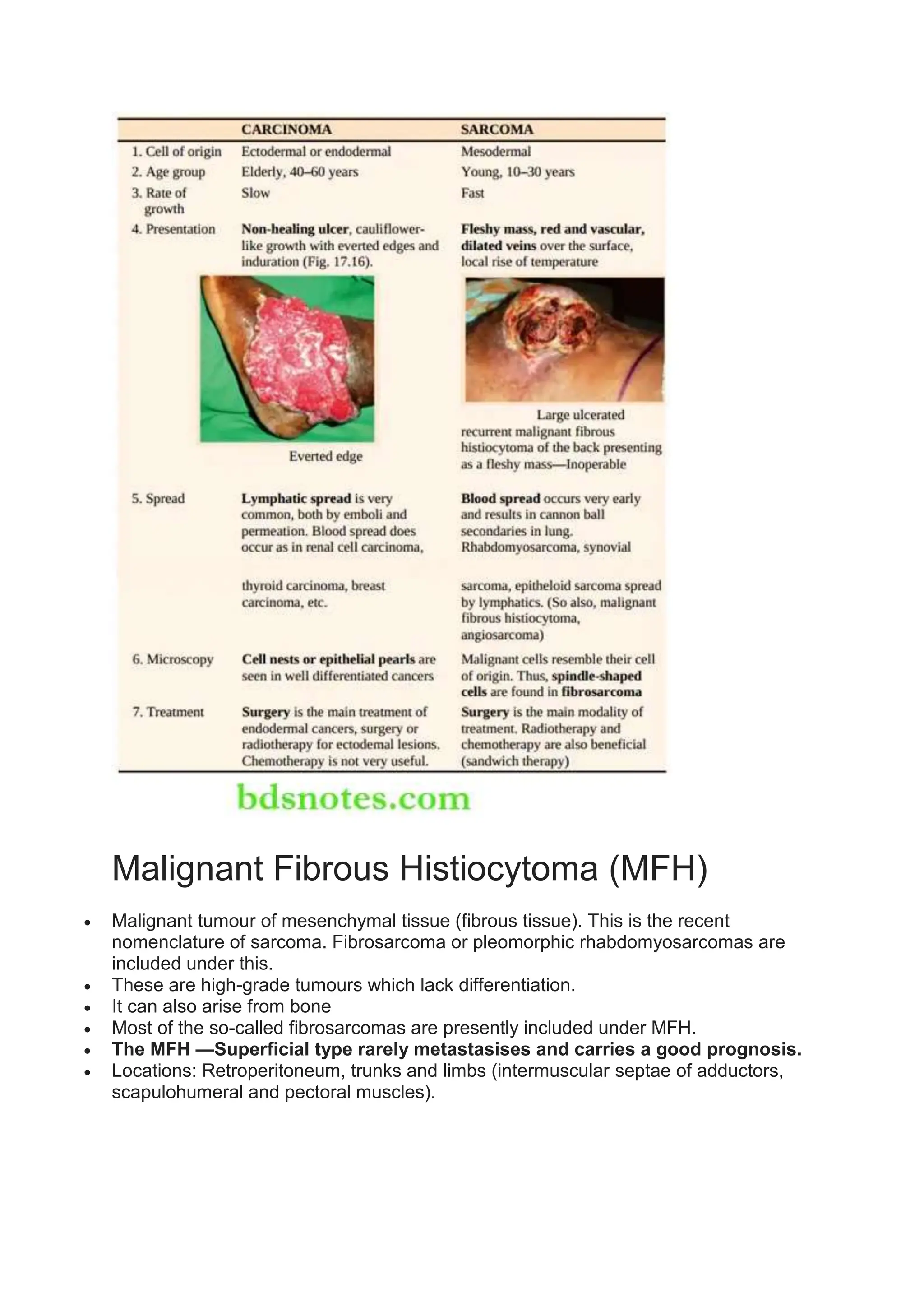 Malignant Tumours Notes Malignant Tumours | DOCX