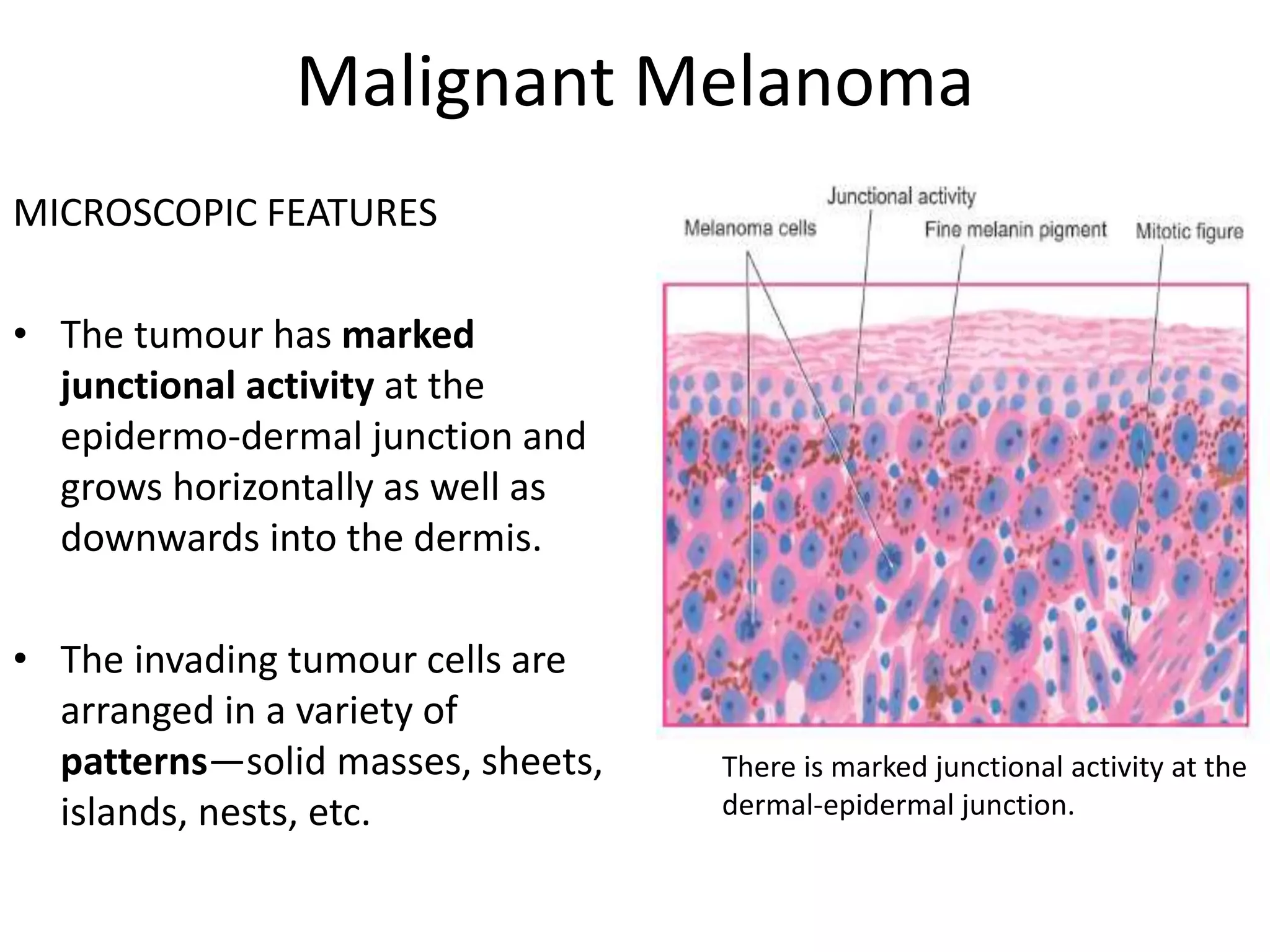 Malignant tumours of the skin | PPTX