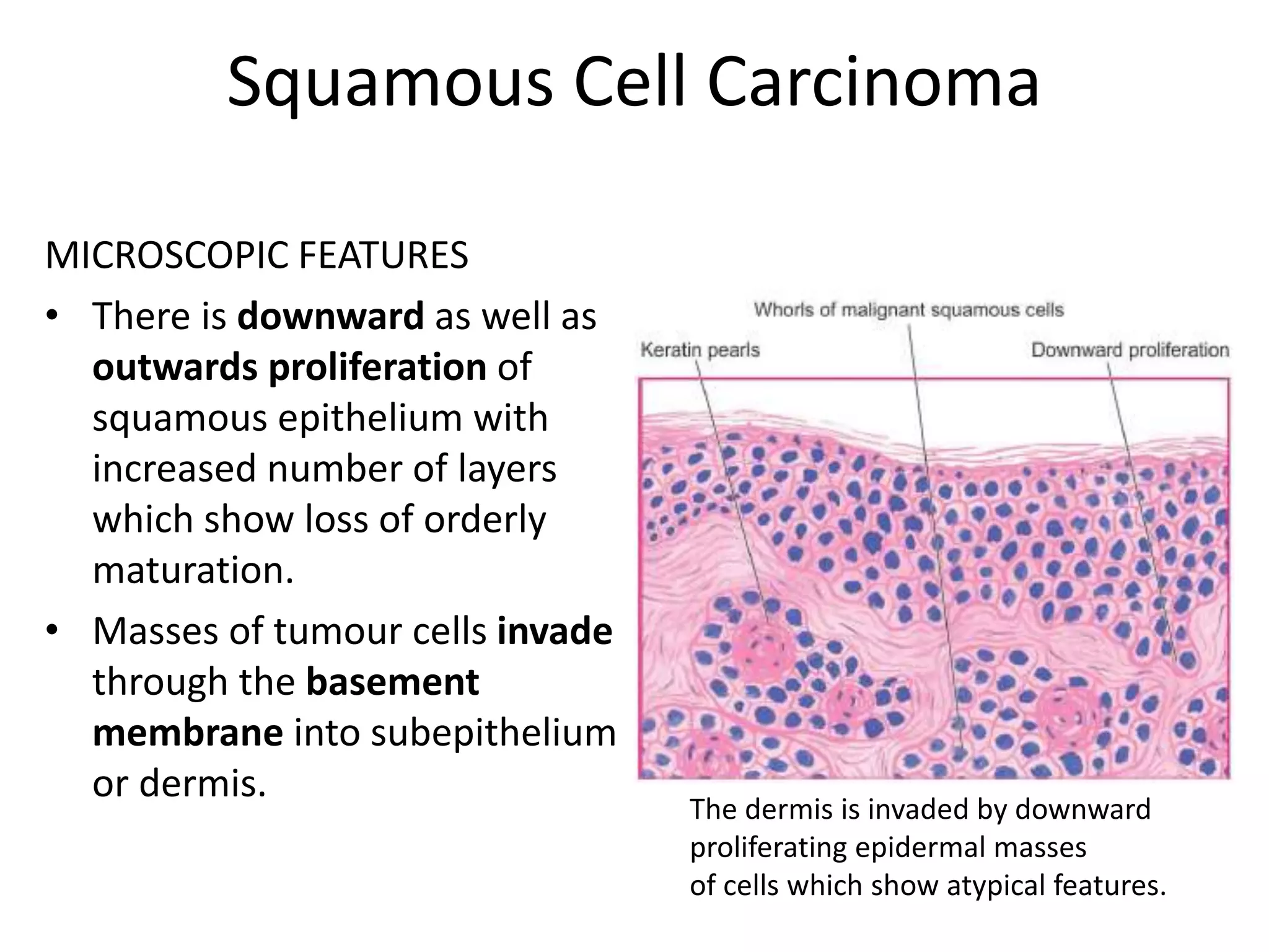 Malignant tumours of the skin | PPTX