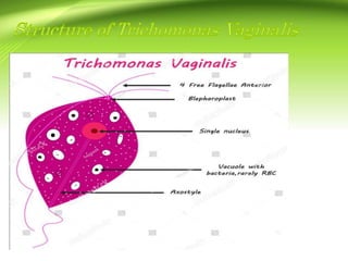 Trichomoniasis | PPTX
