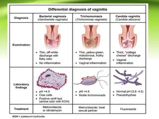 Trichomoniasis Vaginitis