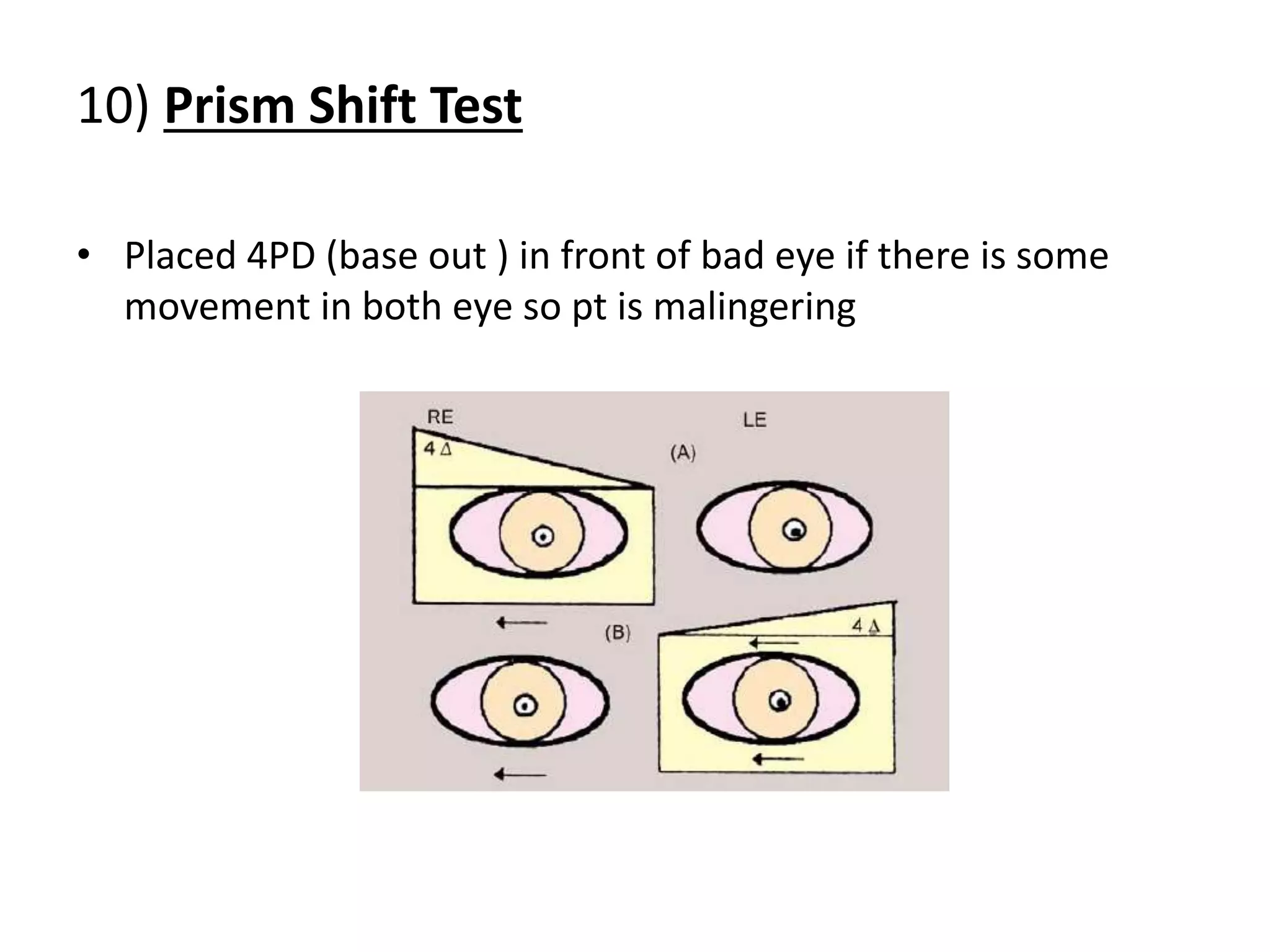 Malingering (Case presentation) | PPTX