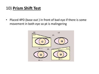 Malingering (Case presentation) | PPTX