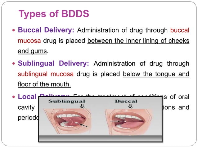 Buccal Drug Delivery System Mali vv ppt | PPTX | Dental Health ...