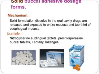 Buccal Drug Delivery System Mali vv ppt | PPTX