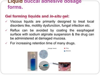 Buccal Drug Delivery System Mali vv ppt | PPTX