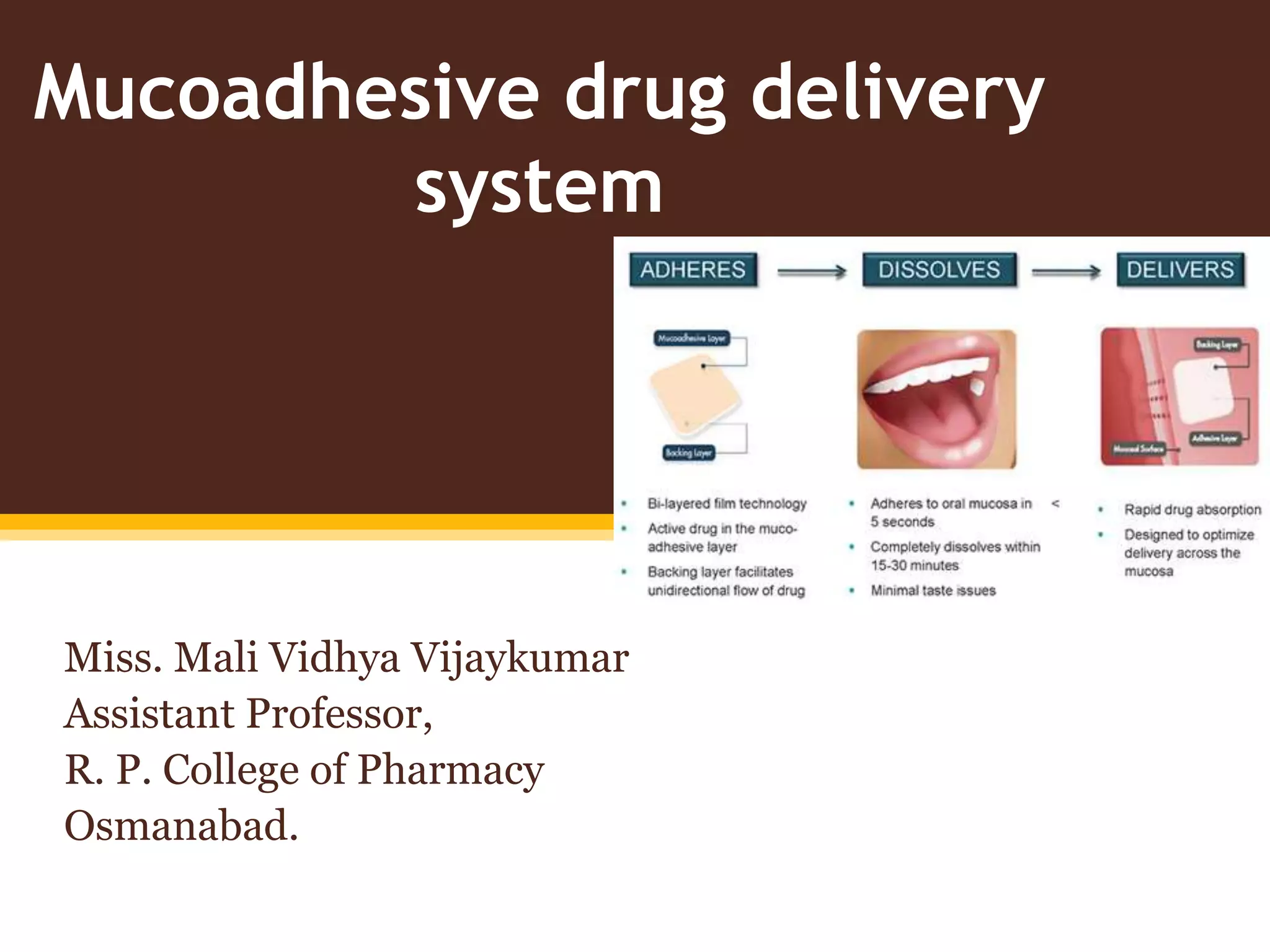 Mucoadhesive drug delivery system Mali vv ppt | PPTX
