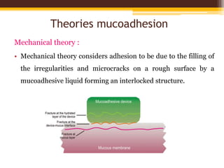 Mucoadhesive drug delivery system Mali vv ppt | PPTX