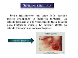 Mallatie bateriche sifilide | PPT