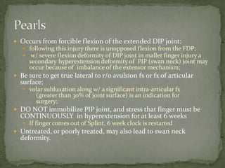 Mallet finger | PPT
