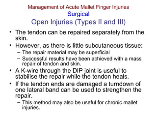 Mallet finger | PPT