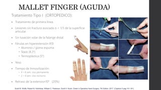 mallet finger dedos trifalangicos mano.pptx