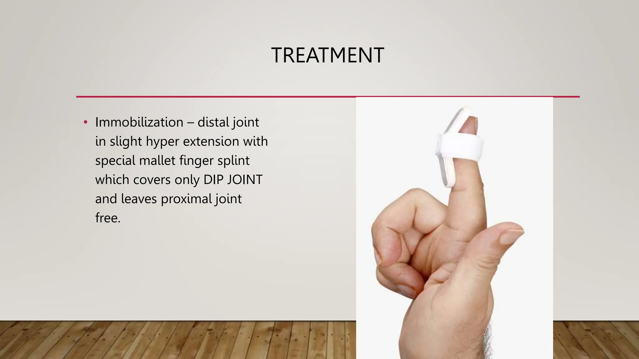 MALLET FINGER TREATMENT & PHYSIOTHERAPY MANAGEMENT | PPTX