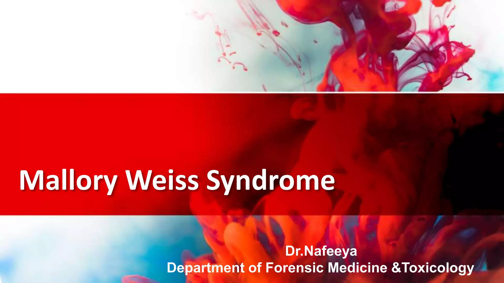 Mallory weiss syndrome | PPTX