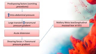 Mallory weiss syndrome | PPTX