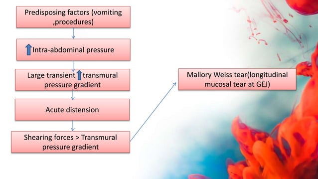 Mallory weiss syndrome | PPT
