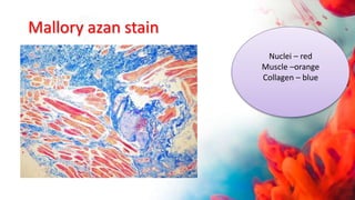 Mallory weiss syndrome | PPTX