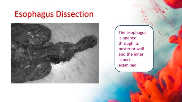 Mallory weiss syndrome | PPT