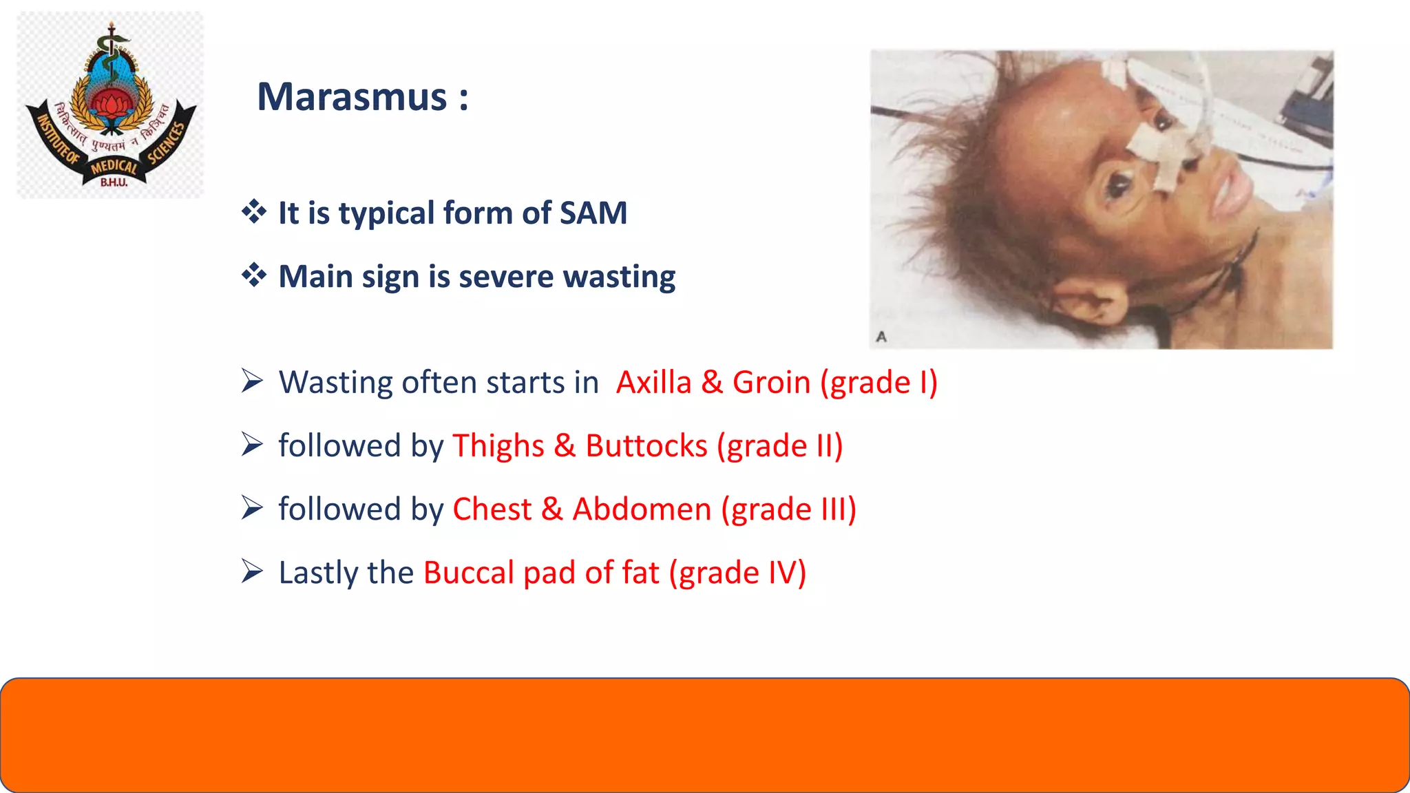 Malnutrition In Indian context | PPTX