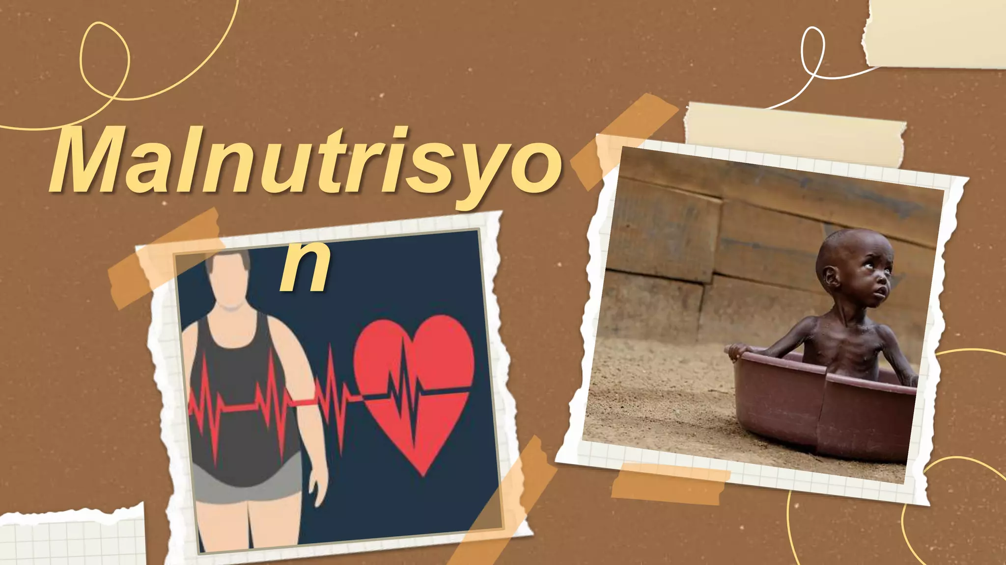 Malnutrisyon(Group 4).pptx