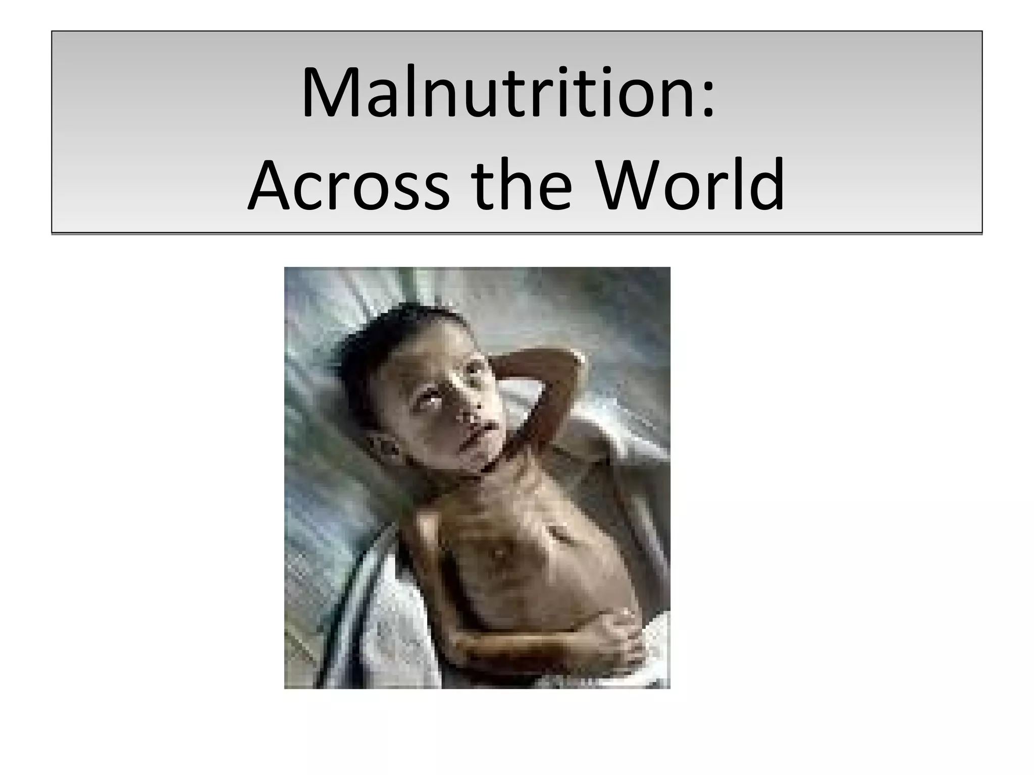 Malnutrition | POT