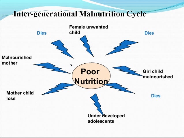 Malnutrition