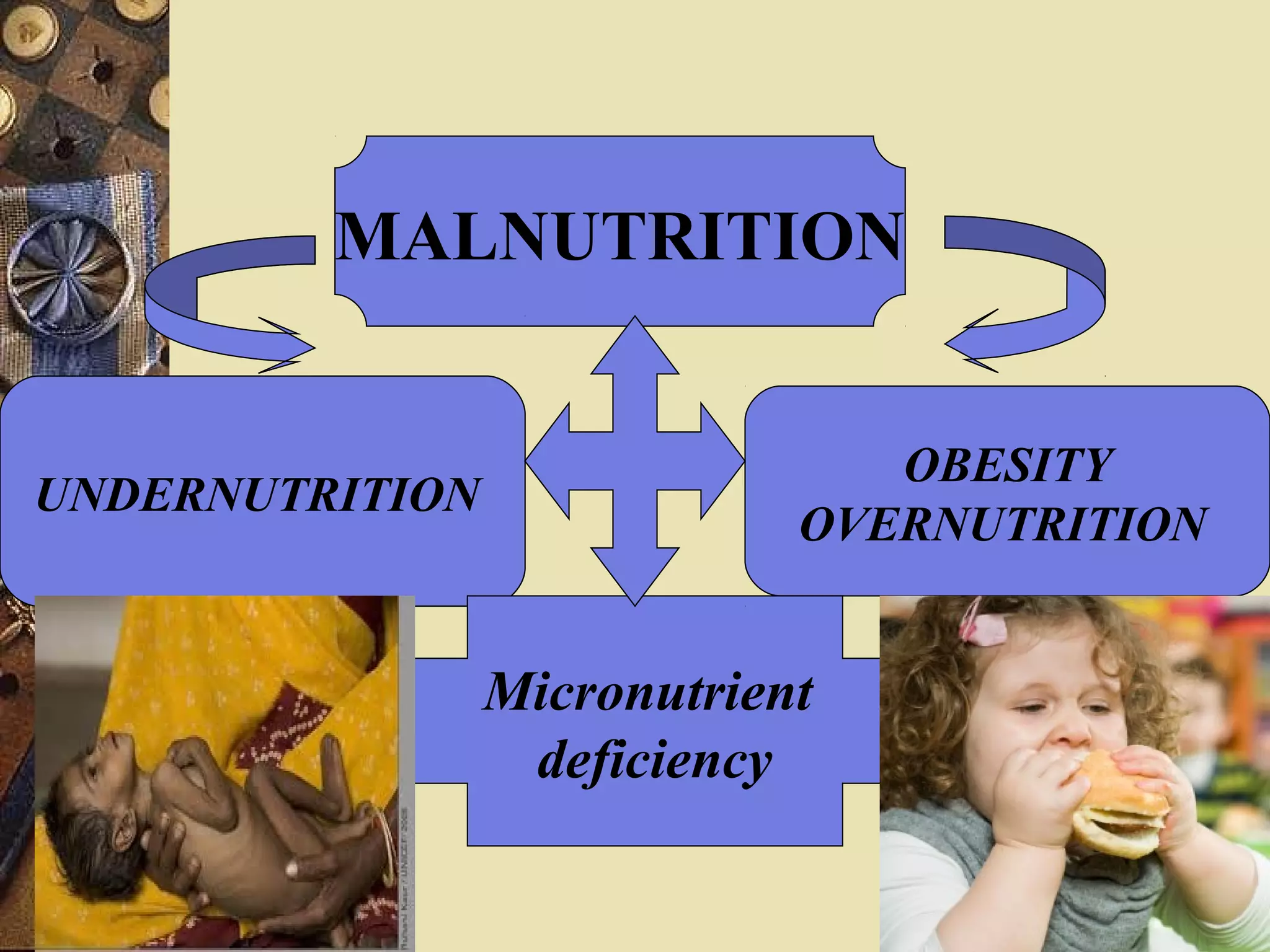Malnutrition | PPT