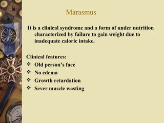 Malnutrition | PPT