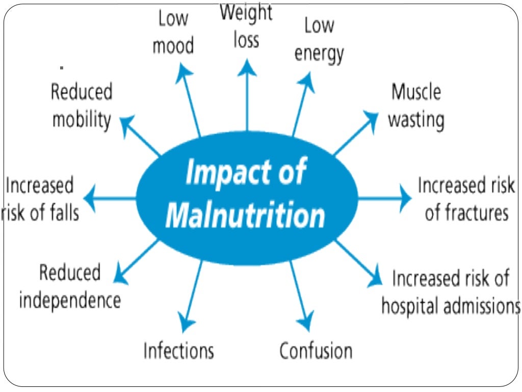 Malnutrition, Causes,Framework, vicious cycle,Preventive measures,Pol…