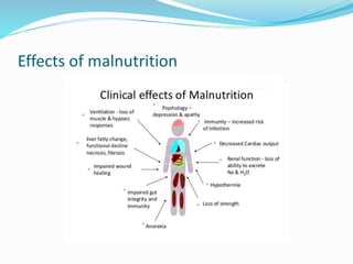 Malnutrition | PPT