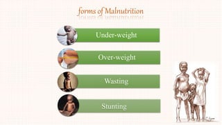Malnutrition | PPT