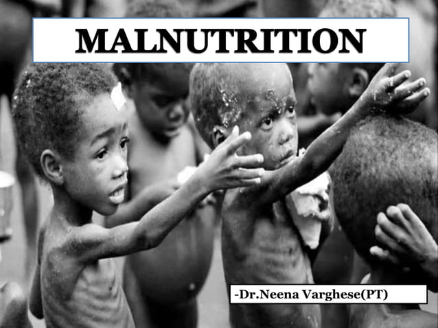 Malnutrition | PPTX | Digestive Disorders | Diseases and Conditions