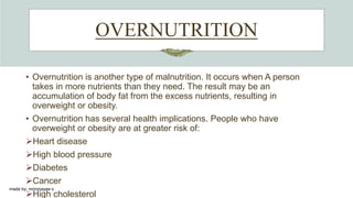 MALNUTRITION.pptx