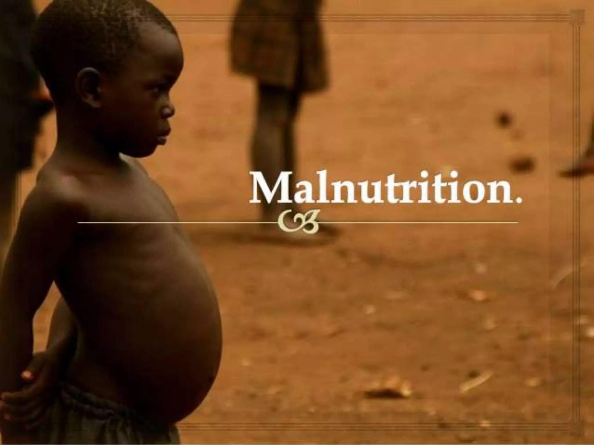 Malnutrition.pptx | Nutrition | Healthy Living
