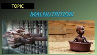 Malnutrition in India: Understanding Undernutrition and Overnutrition | PDF