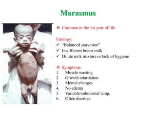 Malnutrition consequences, causes, prevention and control | PPTX